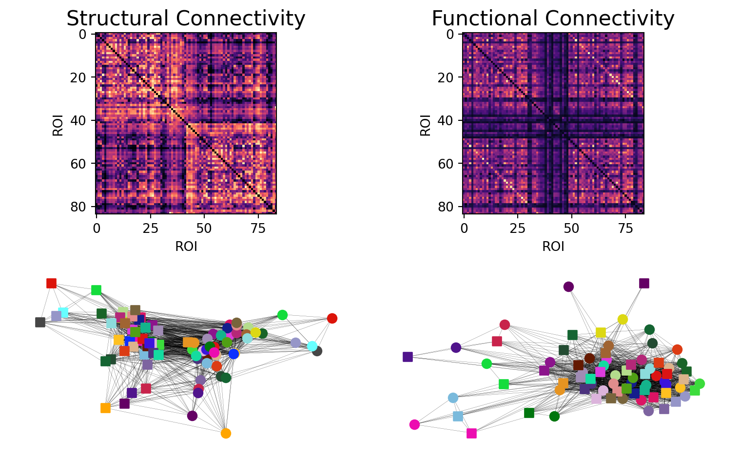 Data Processing for Building Digital Brain Twins with The Virtual Brain